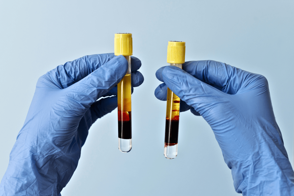 How PRP Therapy Works for Healing | Avid Sports Medicine